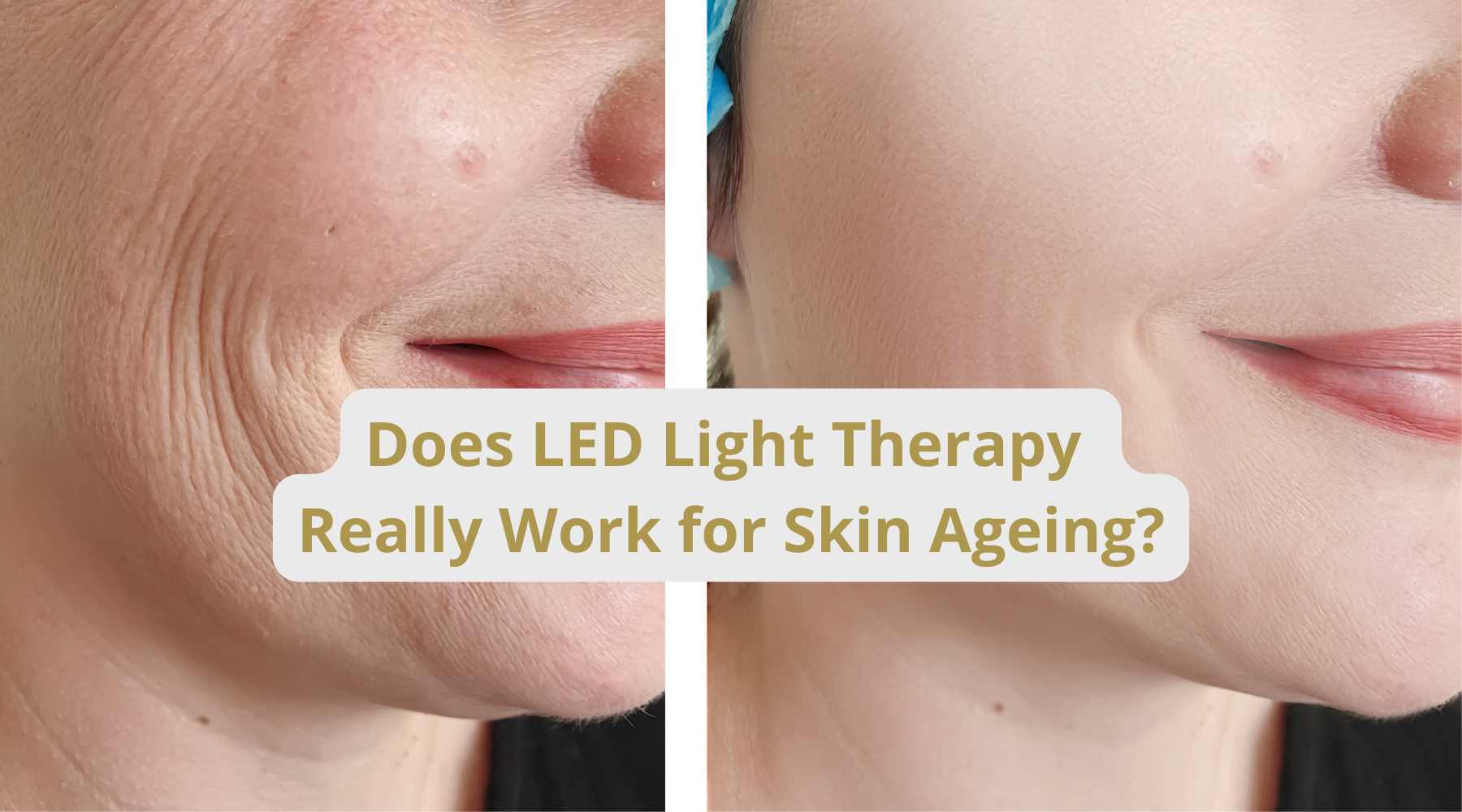 Does LED Light Therapy Work for Ageing Skin? A Science-Based Guide ...